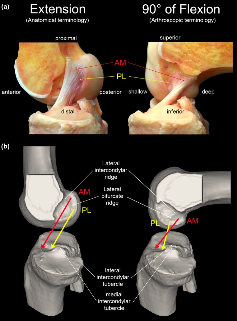 ACL Tear - Knee & Sports - Orthobullets
