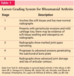 Elbow Arthritis - Shoulder & Elbow - Orthobullets