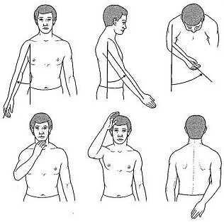 Shoulder Arthrodesis - Shoulder & Elbow - Orthobullets